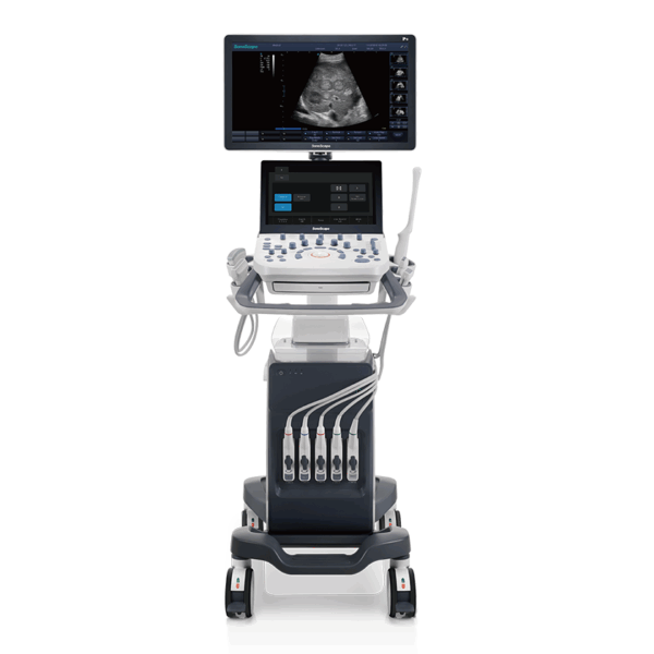 Sonoscape P9 Ultrasound System with 2 Probes – Afya Direct